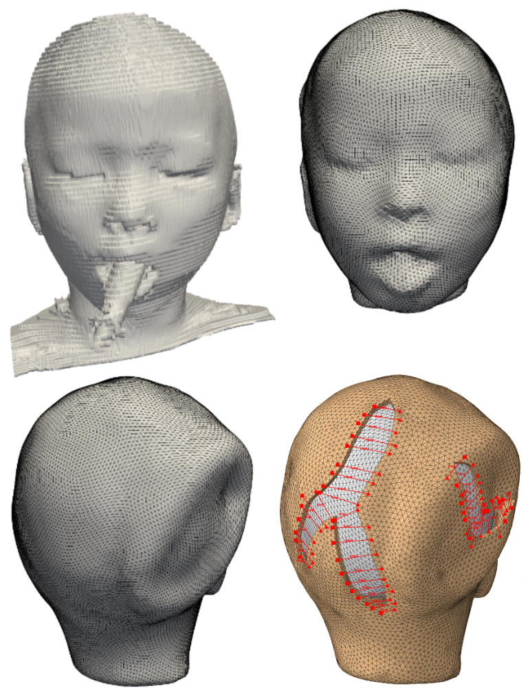 Research - Predictive Modeling and Computational Biomechanics Lab