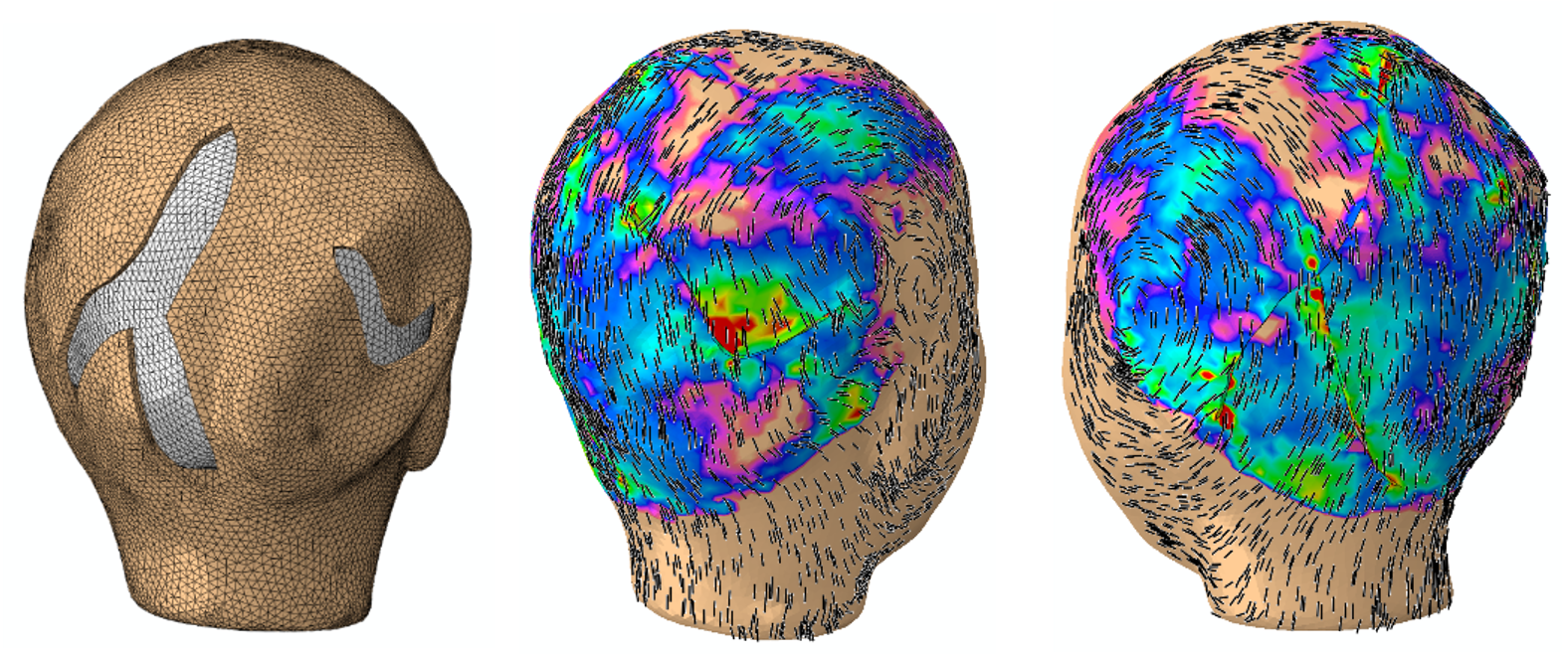 Predictive Modeling and Computational Biomechanics Lab - Myongji University